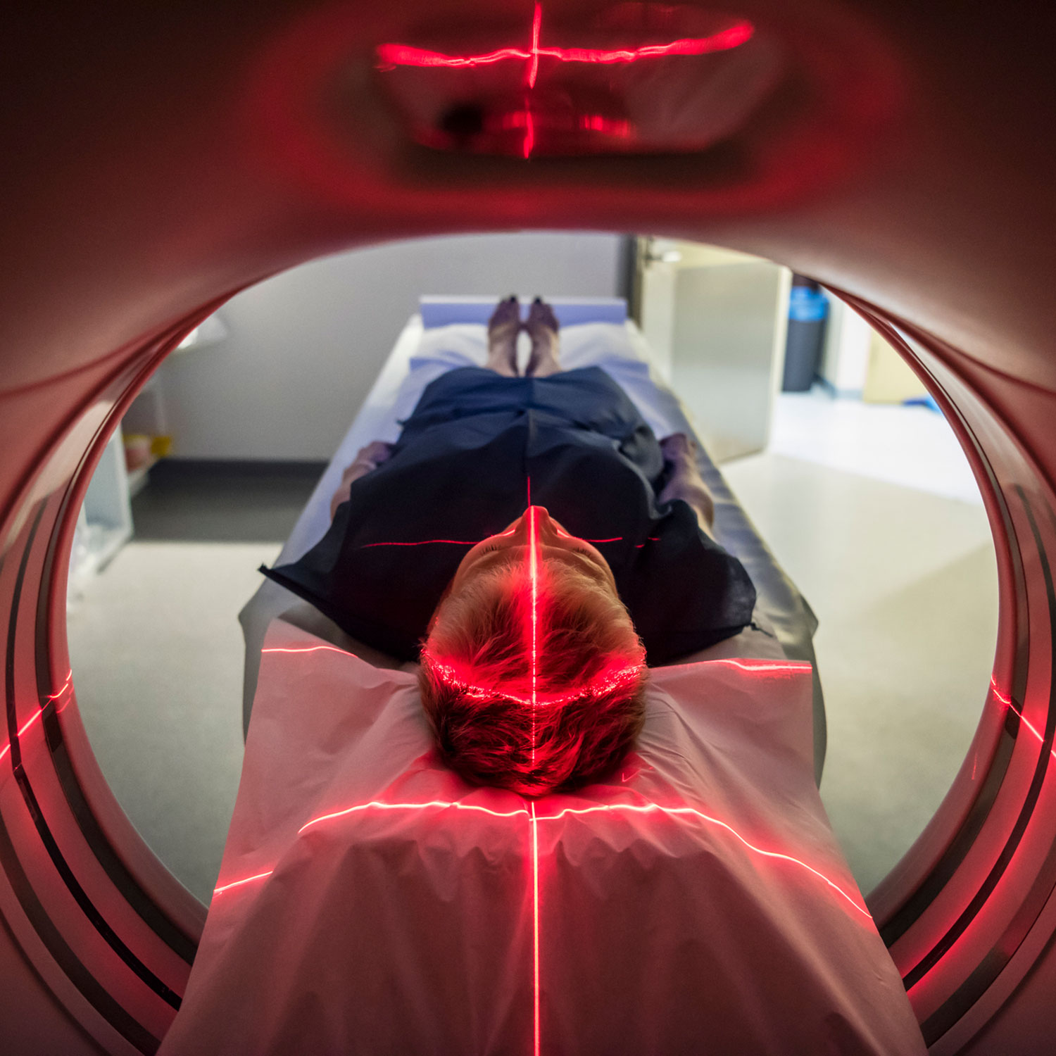 Bladder cancer MRI trial taking place in the Hunter - EIN Presswire